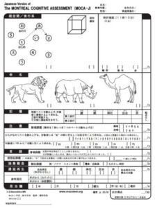 MoCAとは？（Montreal Cognitive Assessment）評価用紙の使い方・カットオフ値と重症度を簡単＆わかりやすく解説 ...